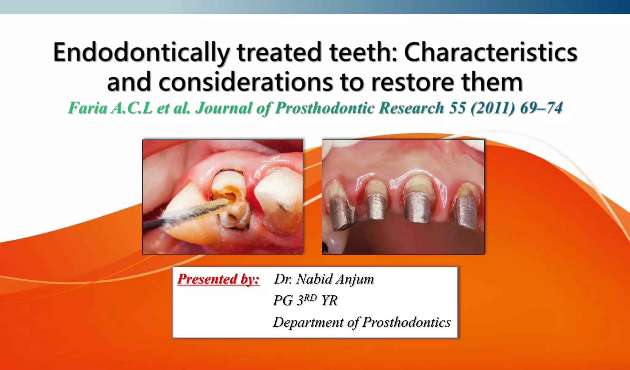 Rehabilitation of endodontically treated teeth : Post & Core | PPTX