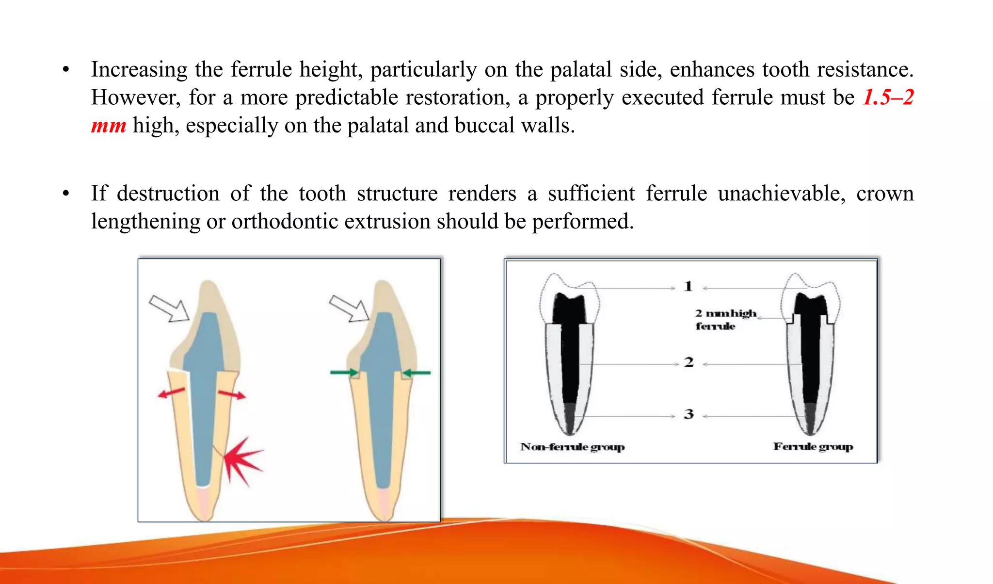 Rehabilitation of endodontically treated teeth : Post & Core | PPTX