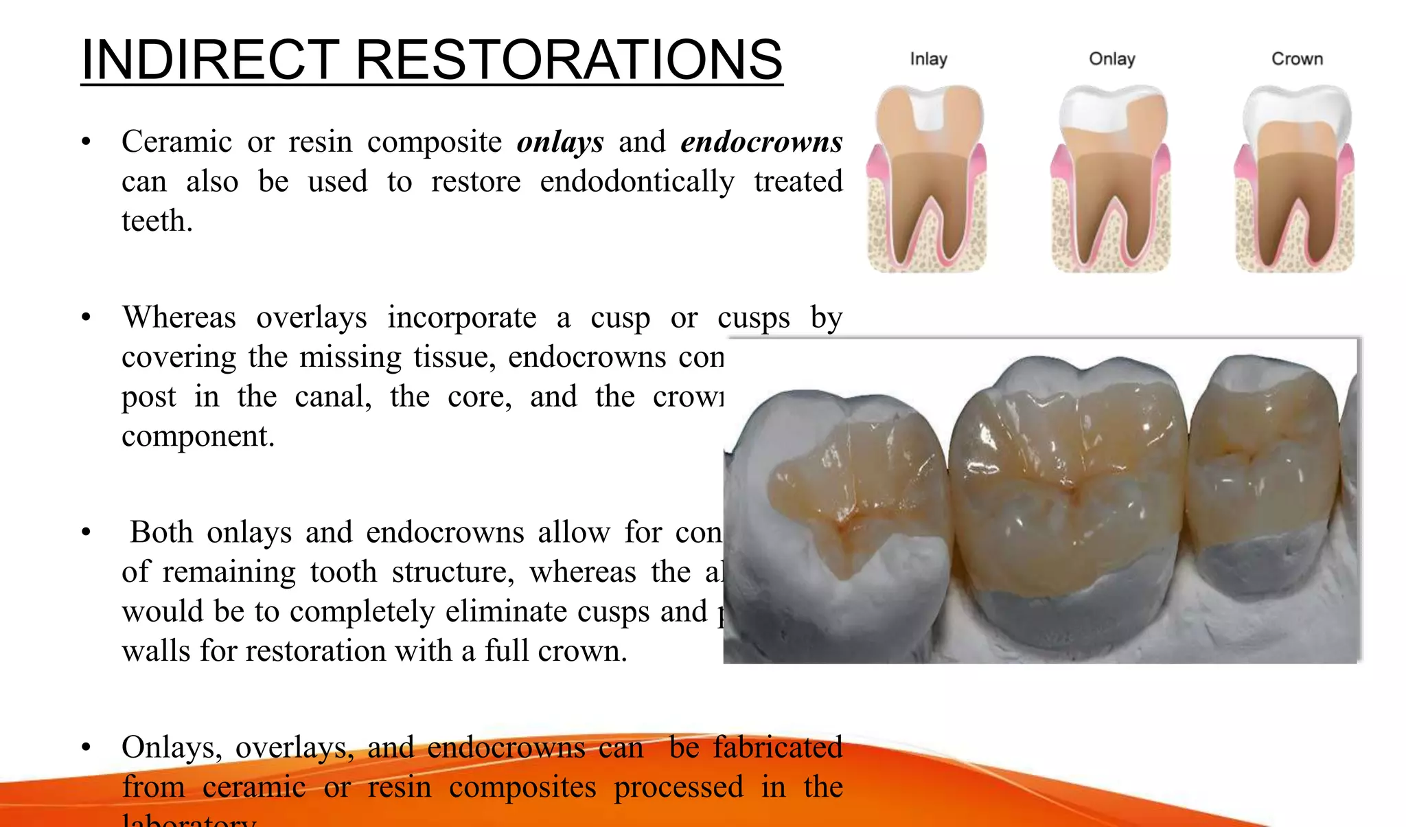 Rehabilitation of endodontically treated teeth : Post & Core | PPTX