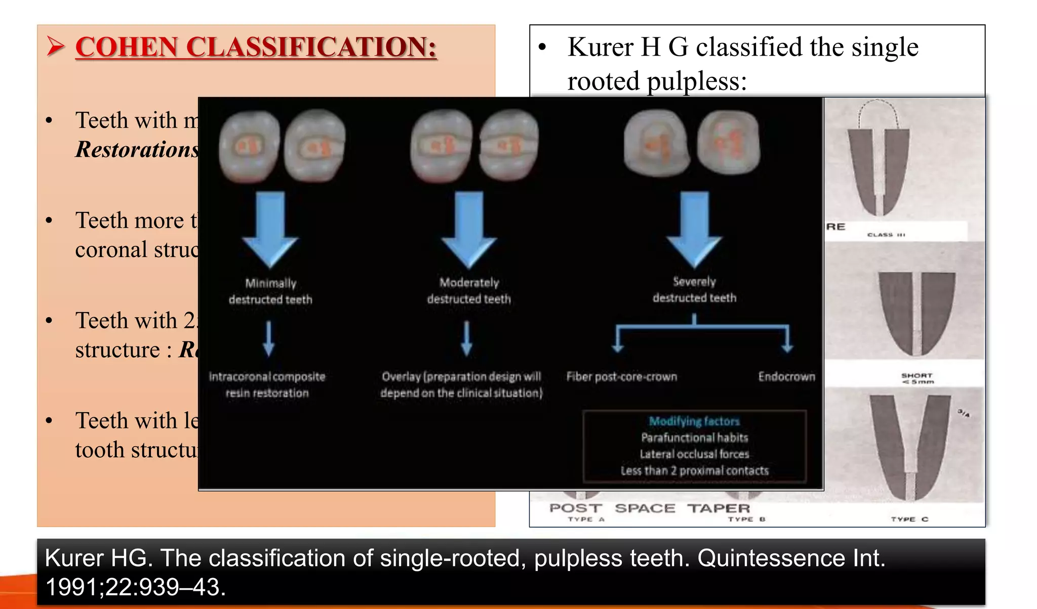 Rehabilitation of endodontically treated teeth : Post & Core | PPTX