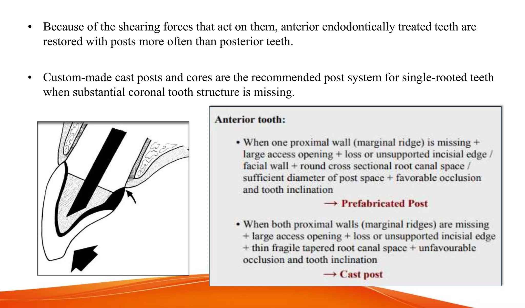 Rehabilitation of endodontically treated teeth : Post & Core | PPTX