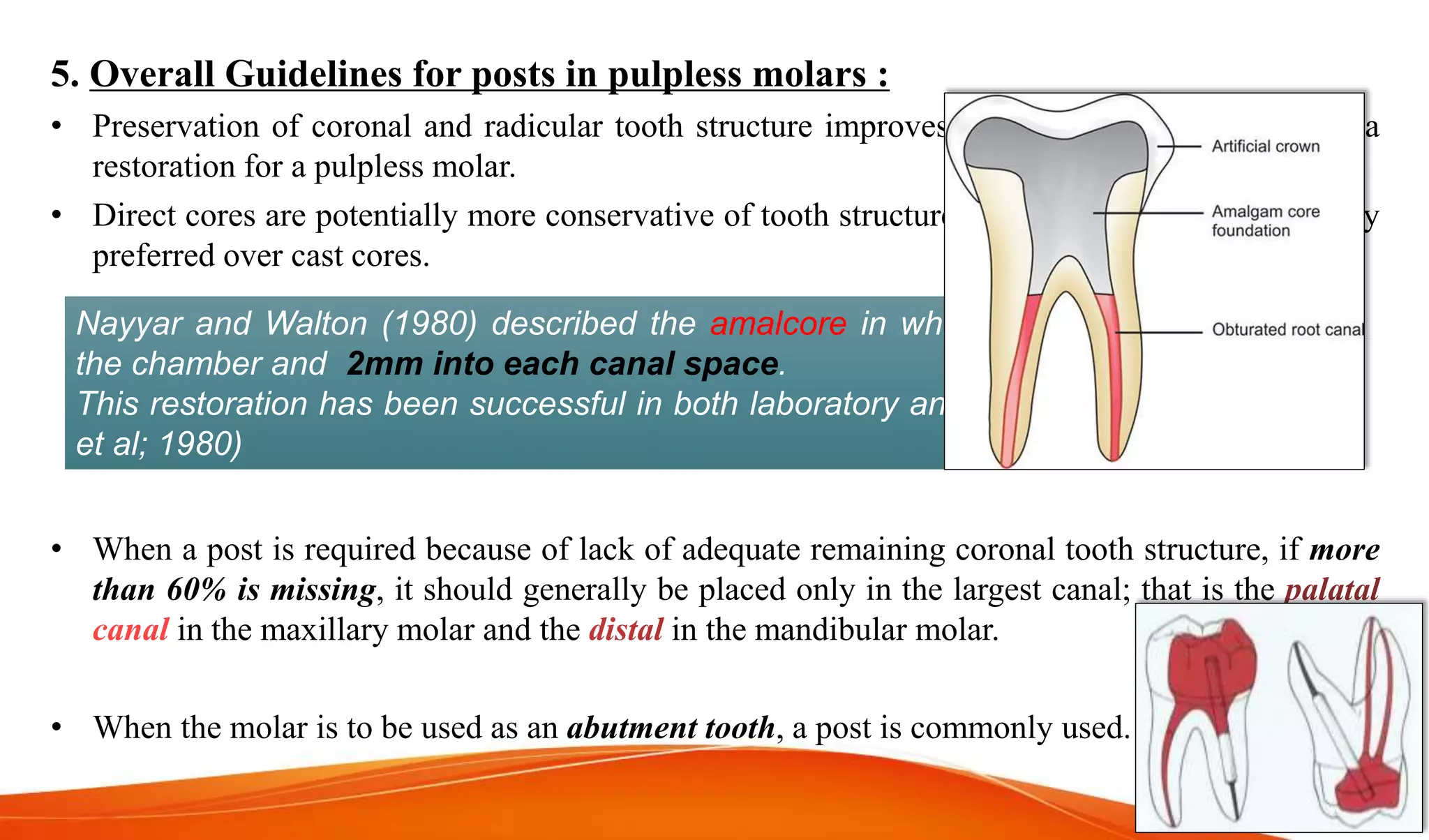 Rehabilitation of endodontically treated teeth : Post & Core | PPTX