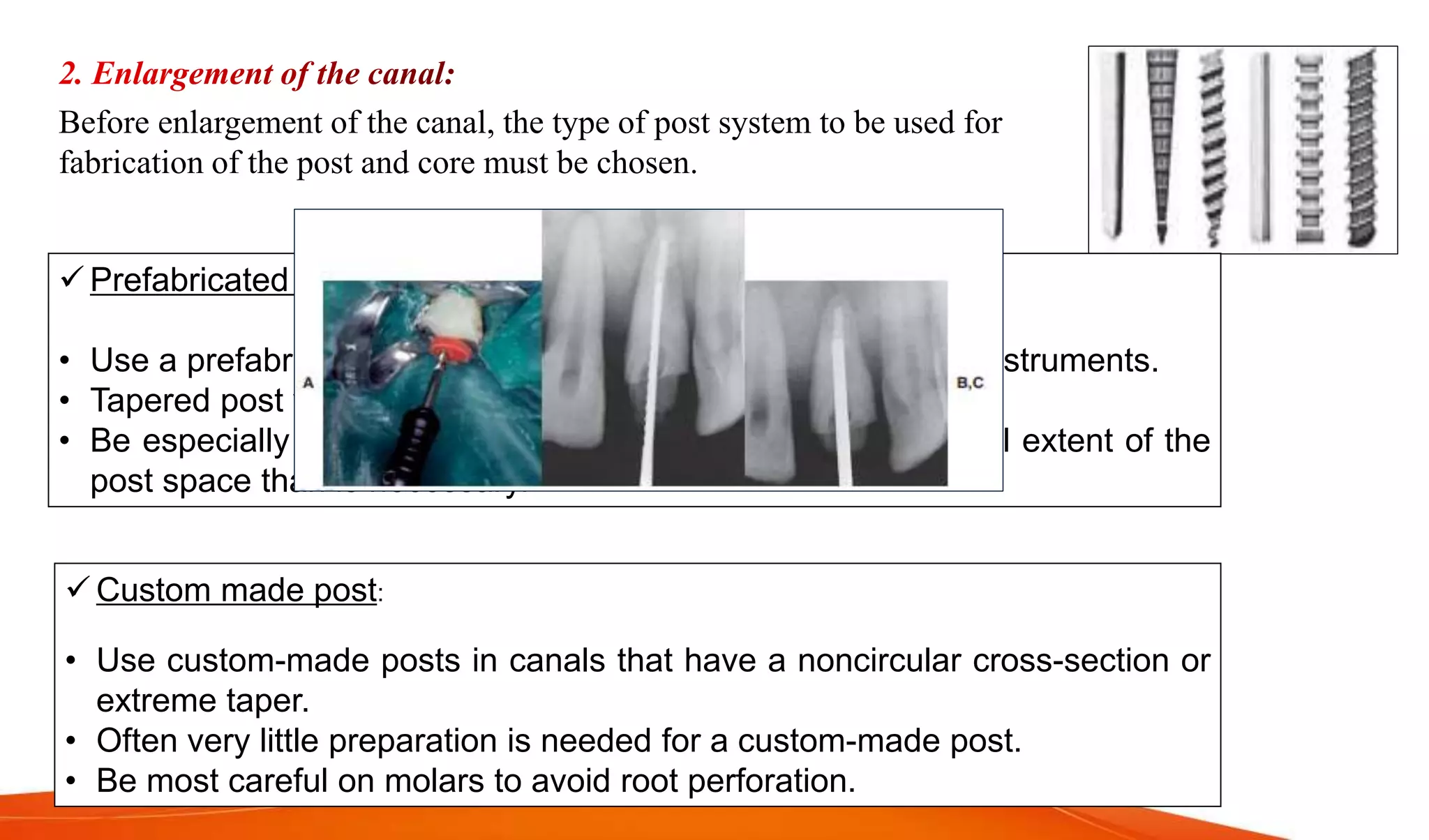 Rehabilitation of endodontically treated teeth : Post & Core | PPTX