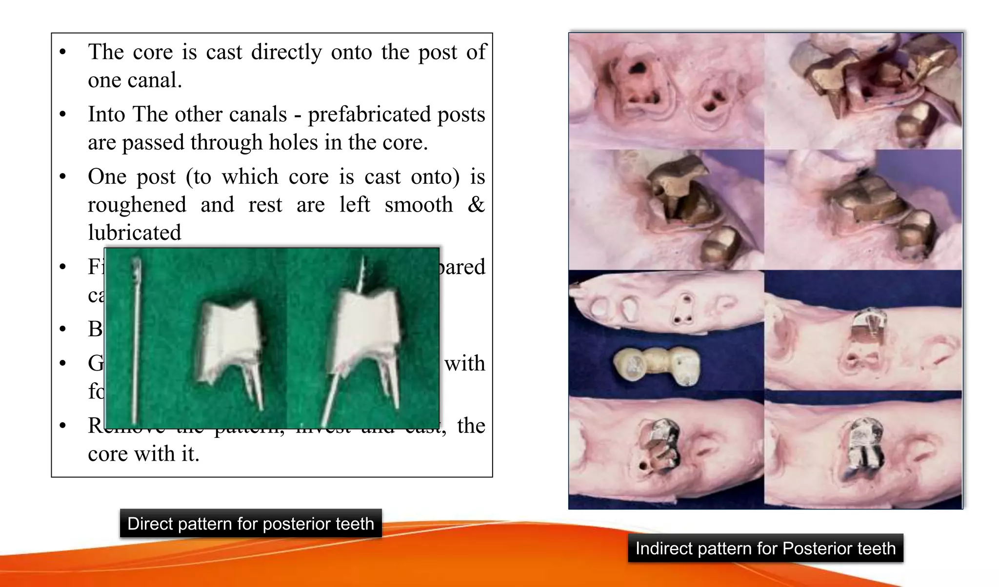 Rehabilitation of endodontically treated teeth : Post & Core | PPTX
