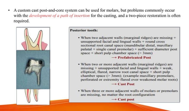 Rehabilitation of endodontically treated teeth : Post & Core | PPTX ...