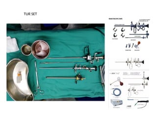 Endourology: a specific specialty area in urology | PPTX