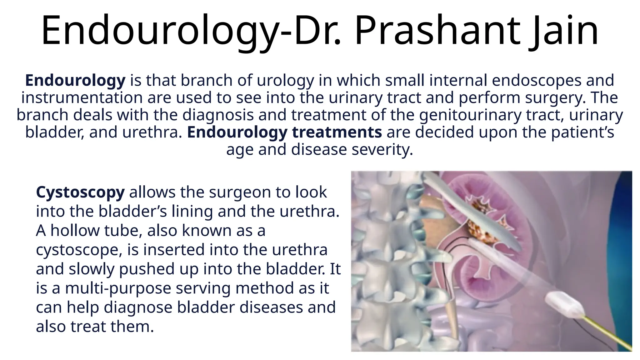 Endourology-Dr. Prashant Jain .pptx.... | PPTX