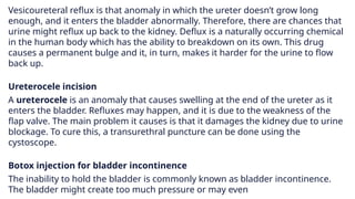 Endourology-Dr. Prashant Jain .pptx.... | PPTX