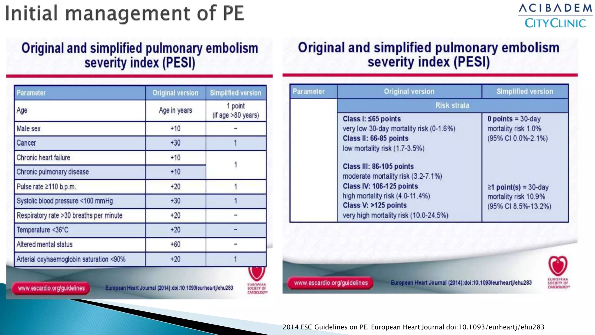 Endovascular and surgical treatment of pulmonary embolism 26.11.17