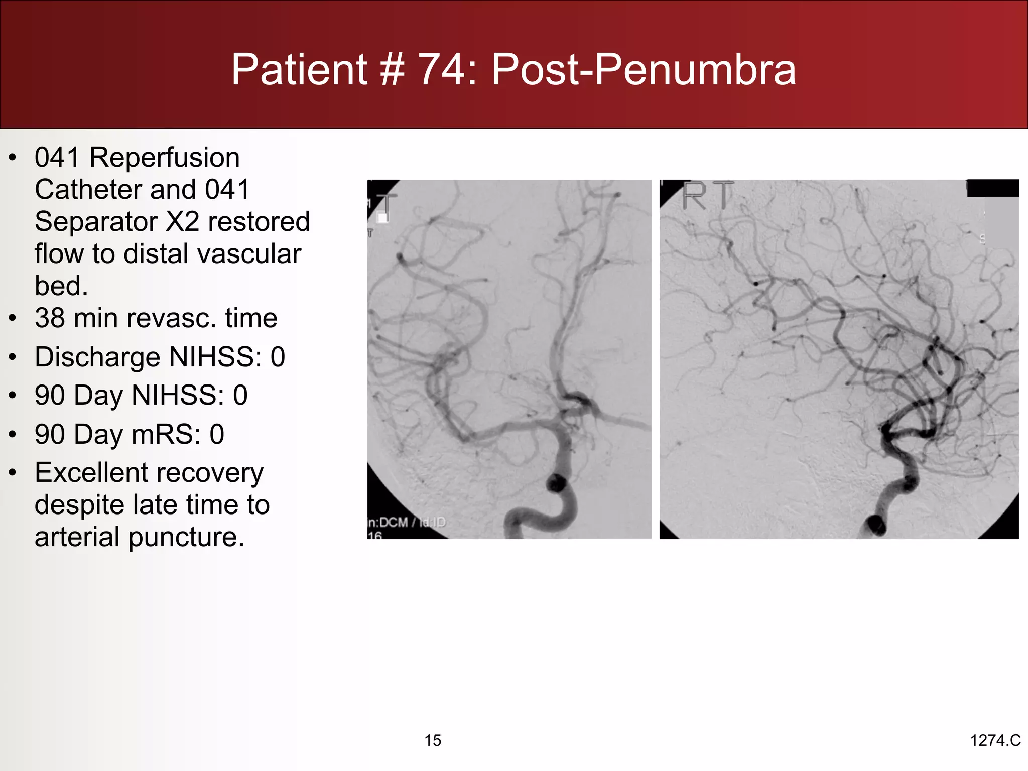 Endovascular Introduction | KEY