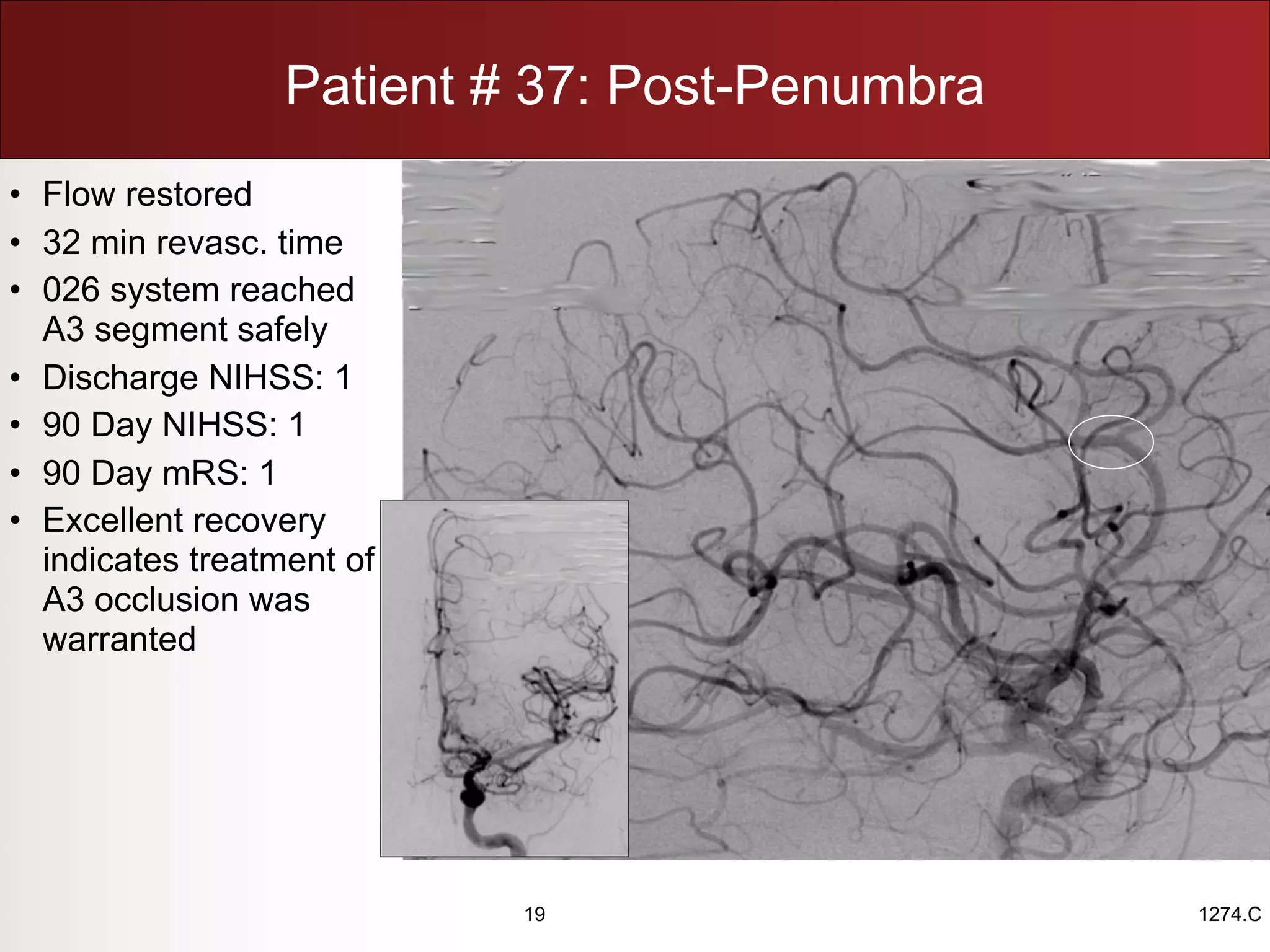 Endovascular Introduction | KEY