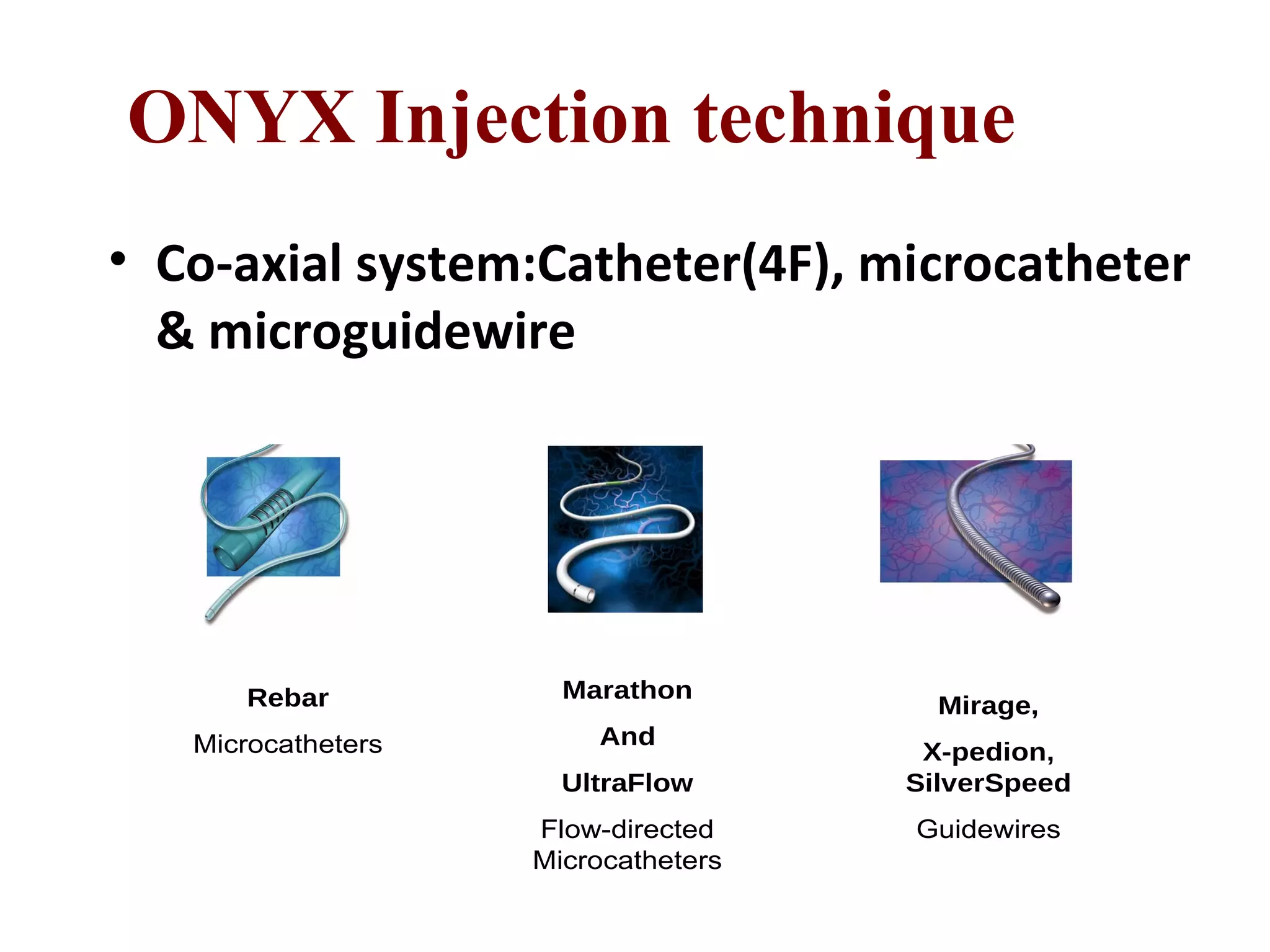 Endovascular management of complex vascular malformations | PPT