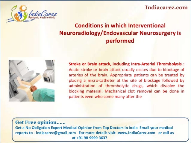 Brain Stroke Surgery Hospital India | Best Endovascular Neurosurgeon