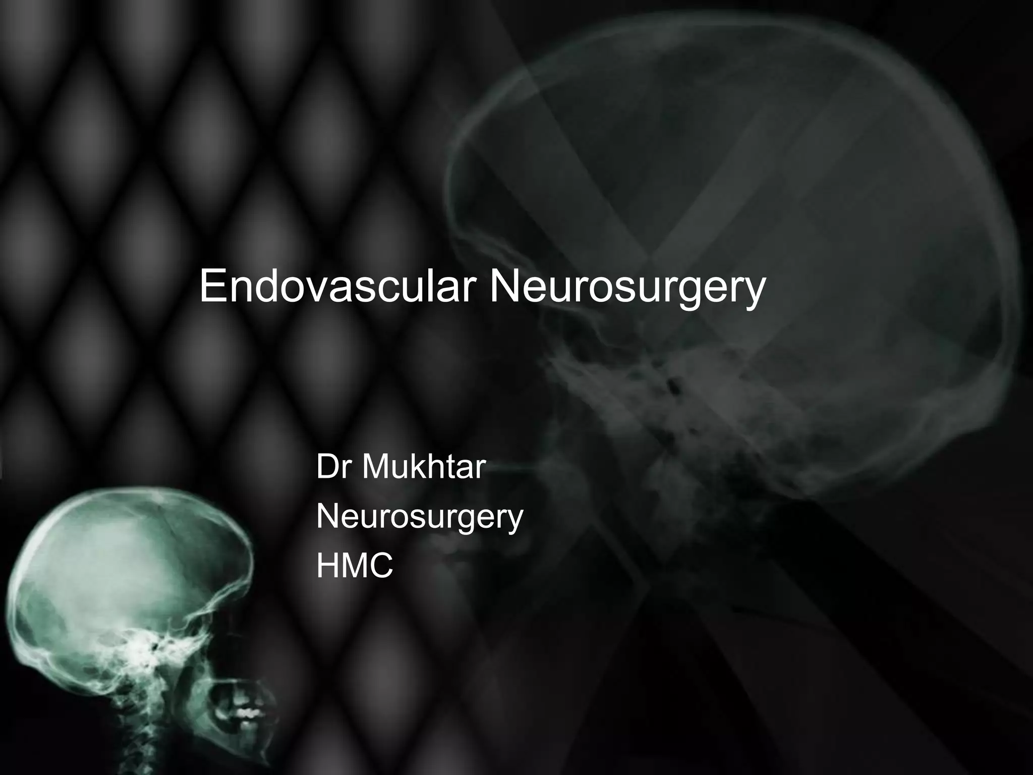 Endovascular neurosurgery | PPTX