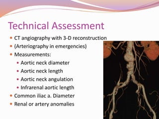 EVAR - Nicola Tanner | PPTX