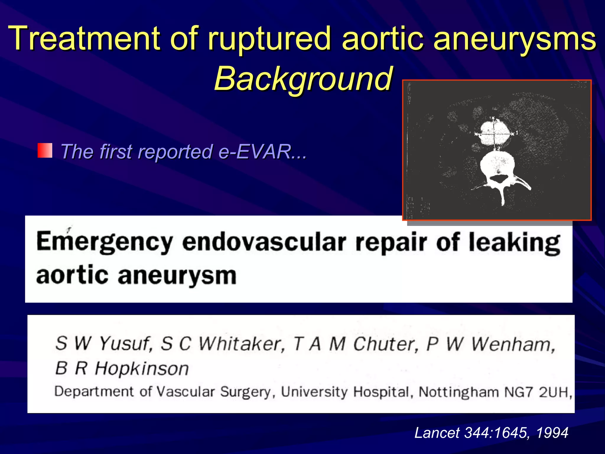 Endovascular repair of traumatic aortic transection six years of ...