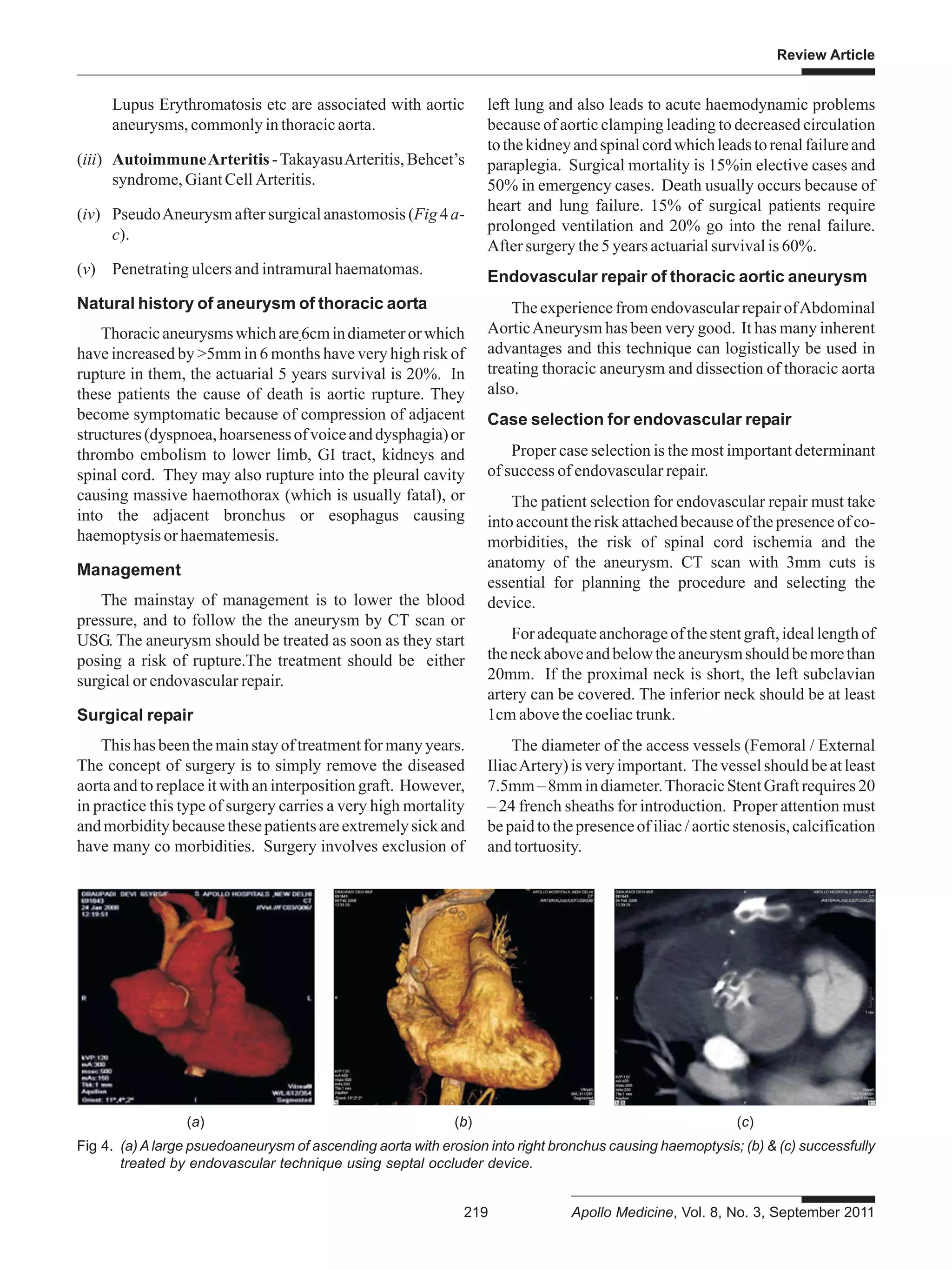 Endovascular repair of thoracic and abdominal aortic aneurysms | PDF