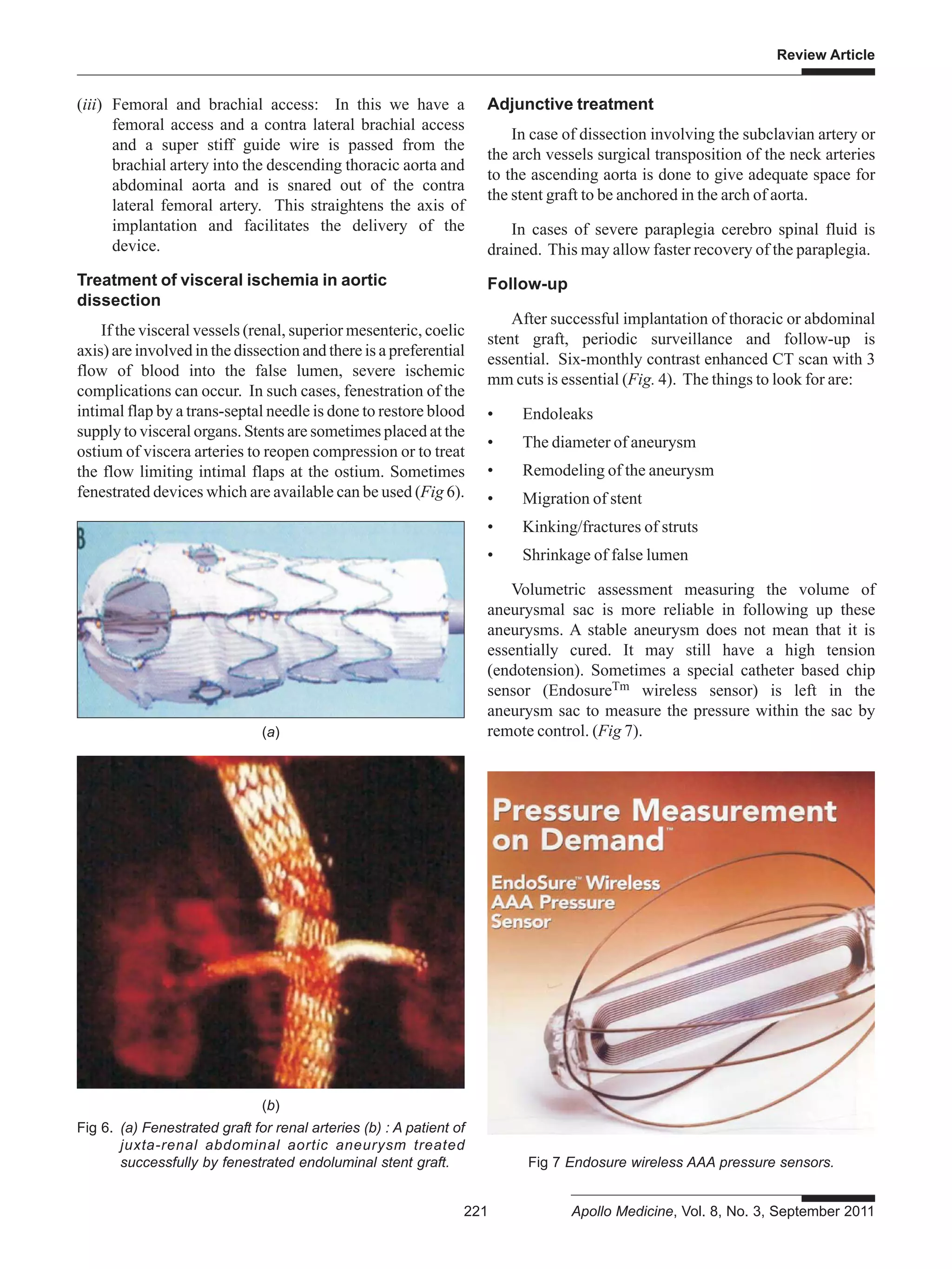 Endovascular repair of thoracic and abdominal aortic aneurysms | PDF