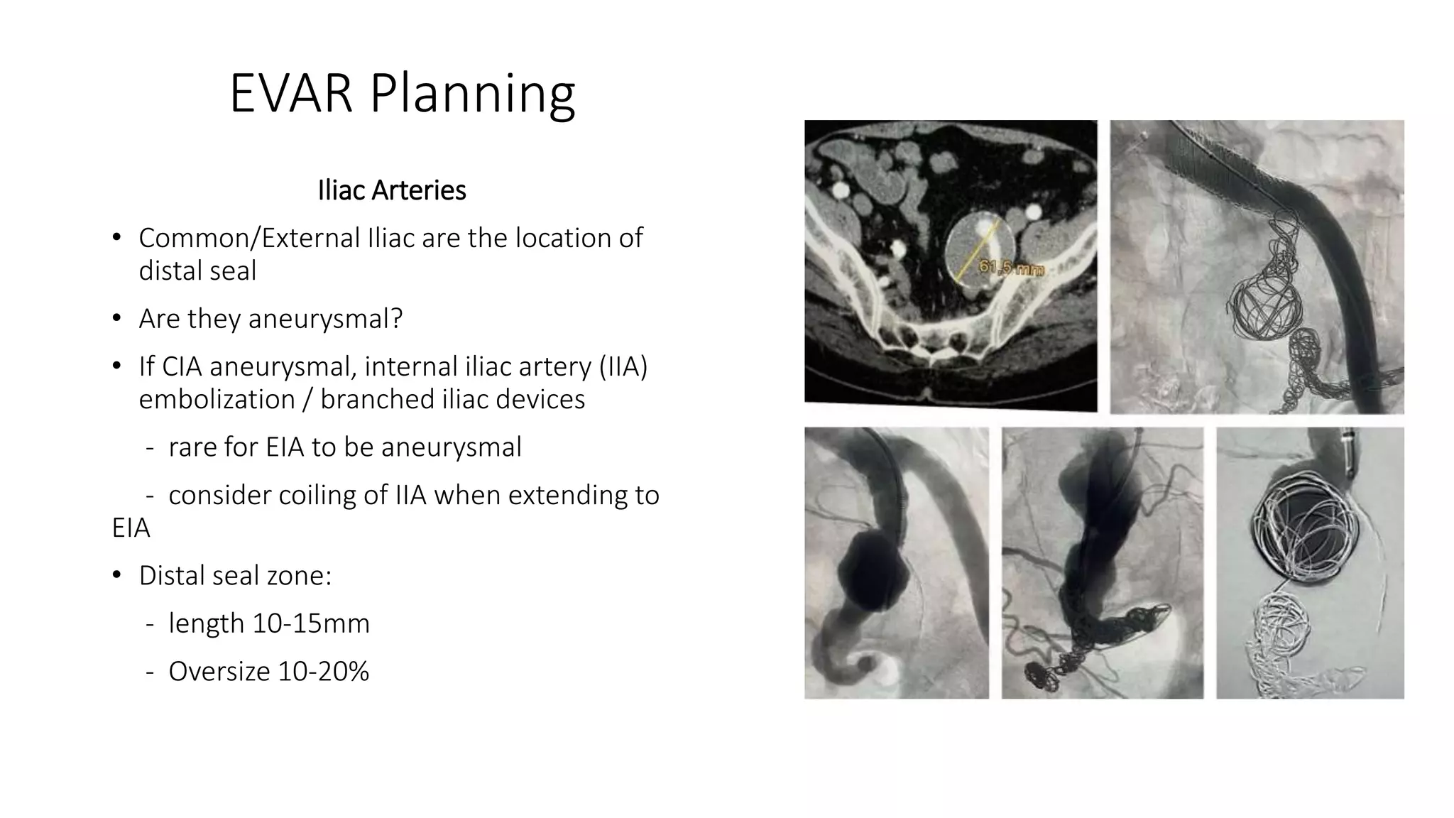 Endovascular Surgery of Abdominal Aorta | PPSX