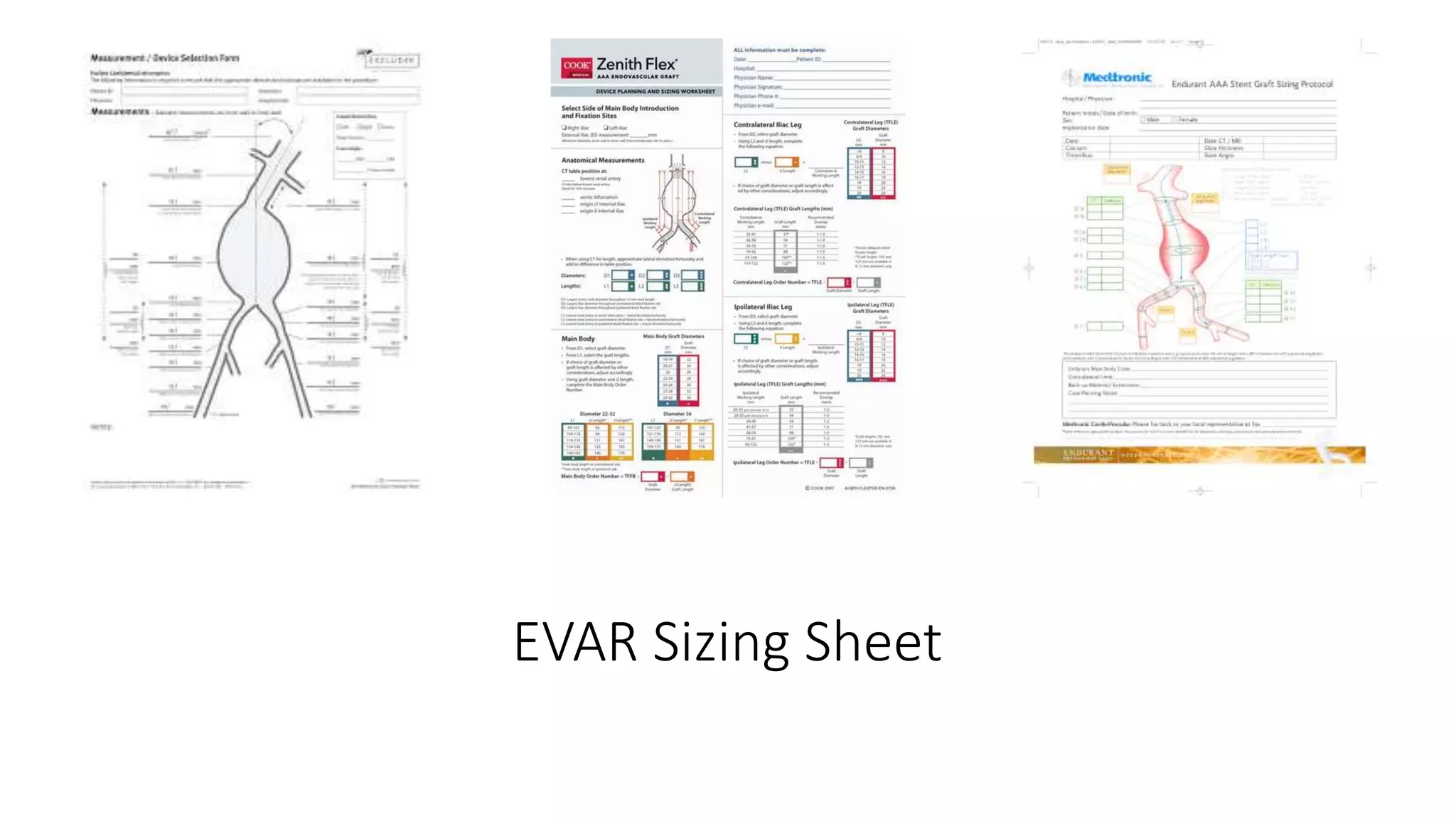 Endovascular Surgery of Abdominal Aorta | PPSX