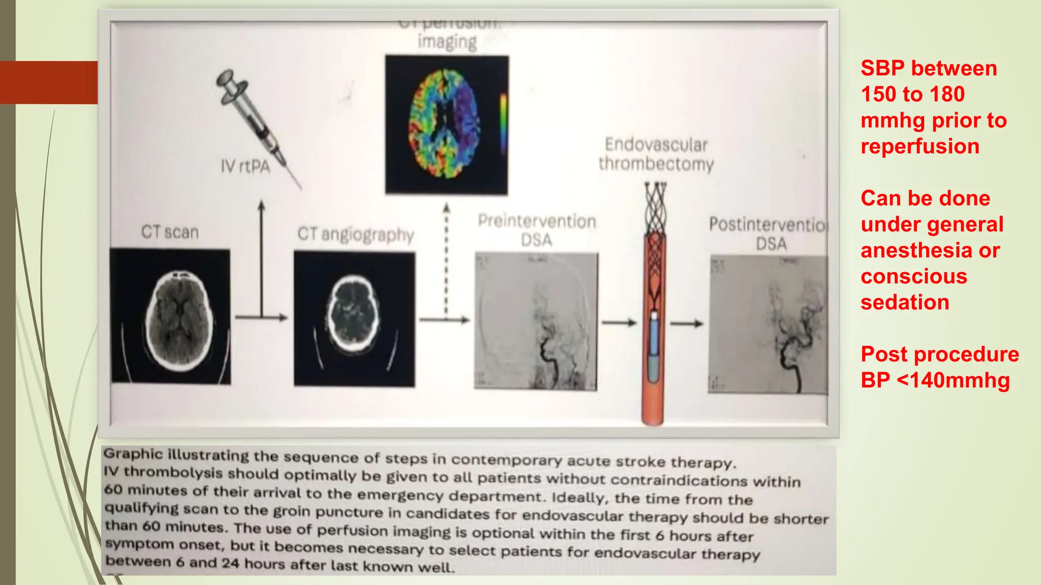 Endovascular therapy Neuro intervention (MT) in AIS Dr Ganesh.pptx