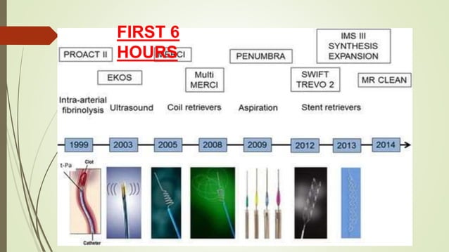 Endovascular therapy Neuro intervention (MT) in AIS Dr Ganesh.pptx ...