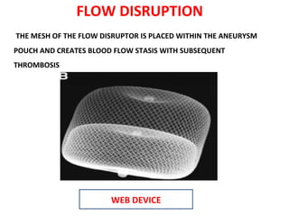 Endovascular treatment of cerebral aneurysms | PPT