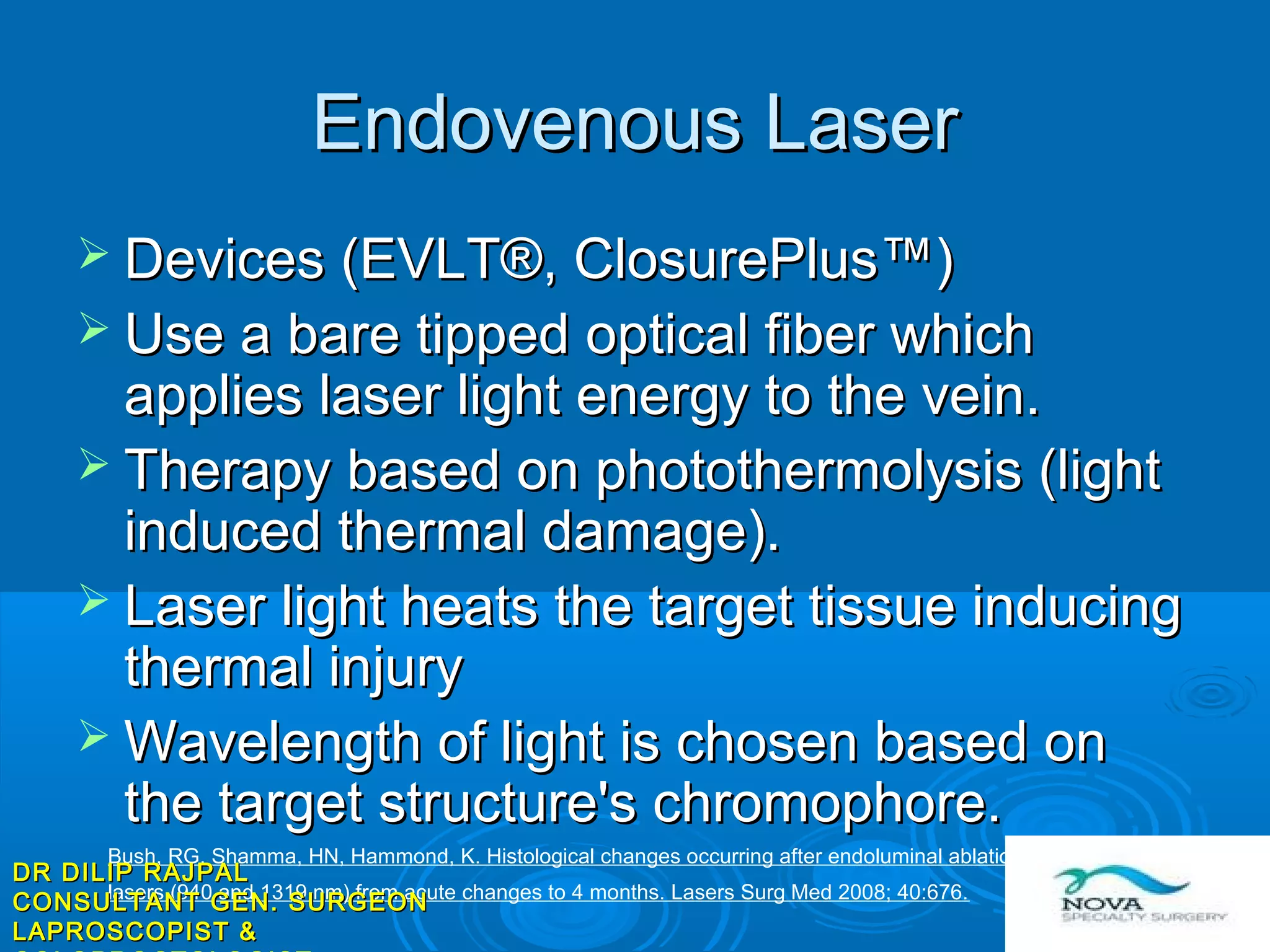 Endovenous laser ablation | PPT