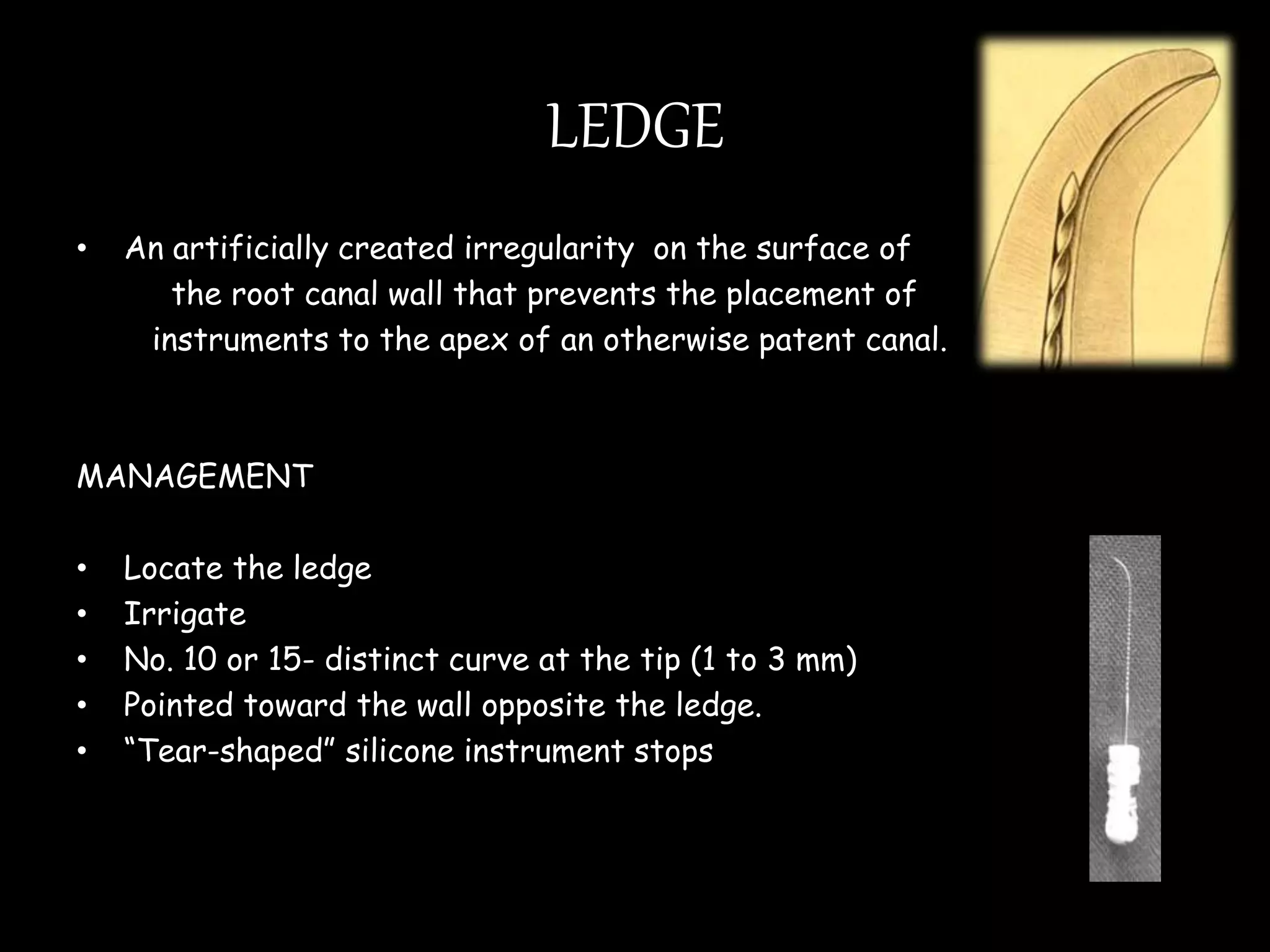 retreatment in endo | PPTX