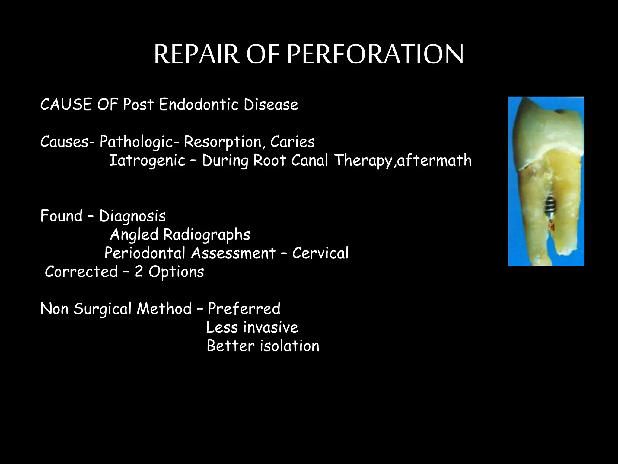 retreatment in endo | PPTX