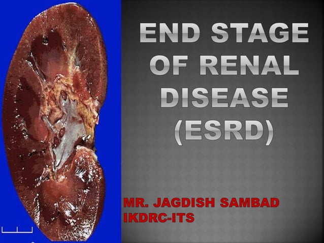 End stage of renal disease | PPT | Blood Disorders | Diseases and ...