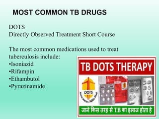End TB Save Lives.pptx