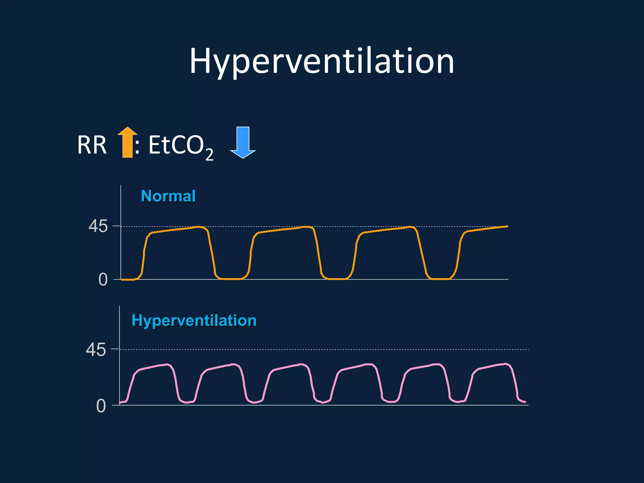 End tidal co2 and transcutaneous monitoring | PPTX