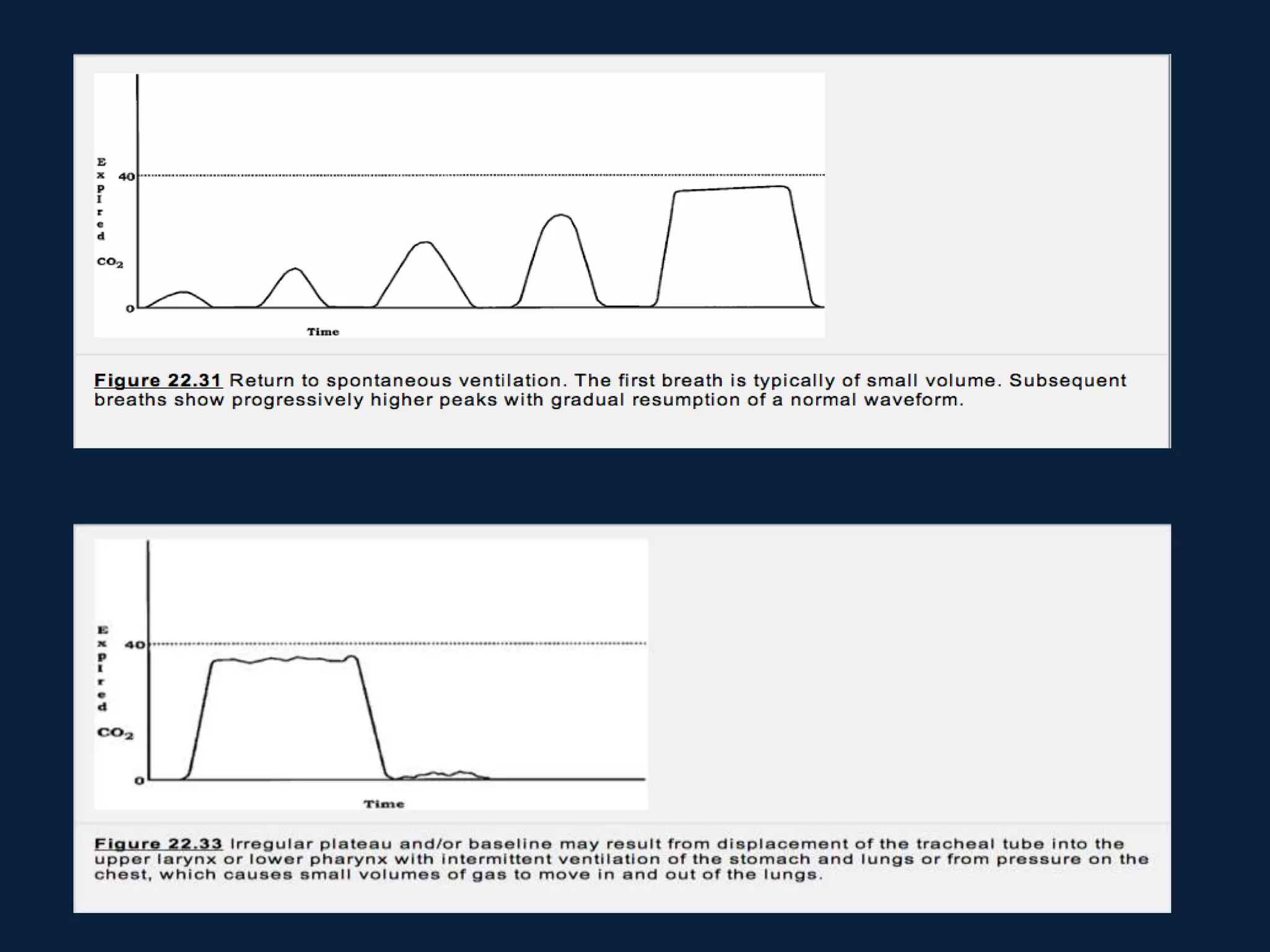 End tidal co2 and transcutaneous monitoring | PPTX
