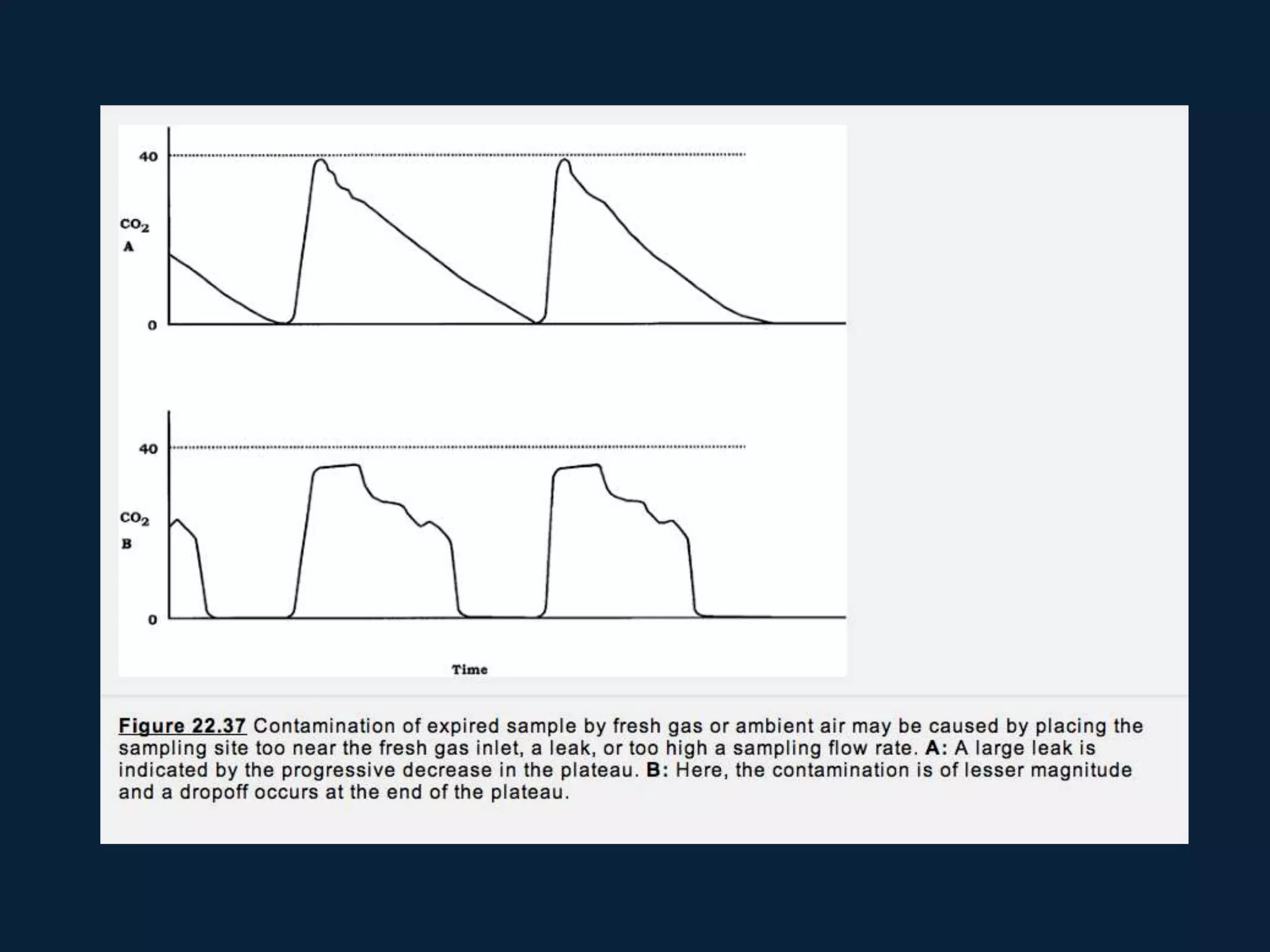 End tidal co2 and transcutaneous monitoring | PPTX