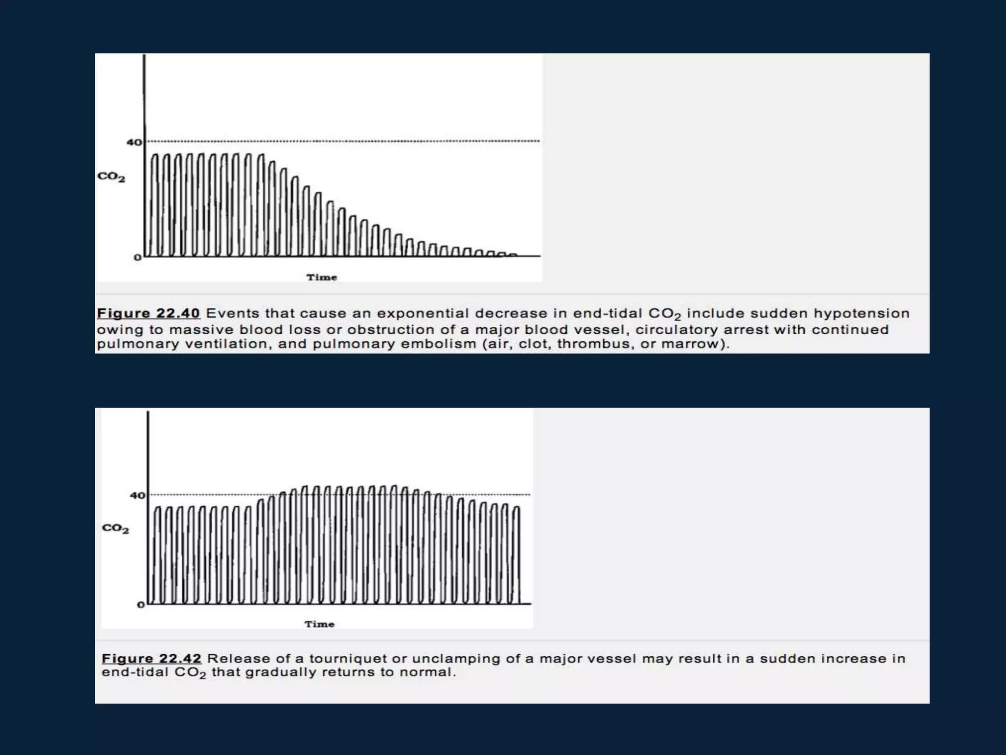 End tidal co2 and transcutaneous monitoring | PPTX