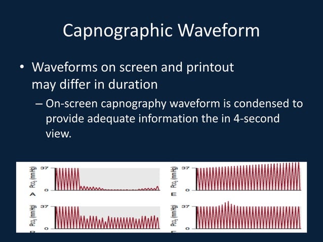 End tidal co2 and transcutaneous monitoring | PPTX | Lung and ...