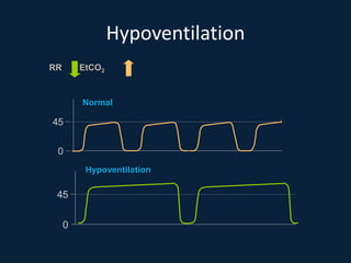 End tidal co2 and transcutaneous monitoring | PPTX