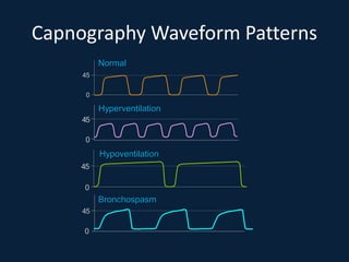 End tidal co2 and transcutaneous monitoring | PPTX