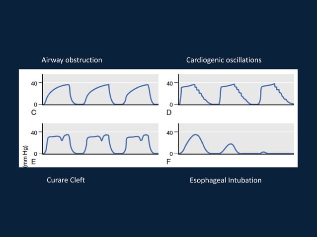 End tidal co2 and transcutaneous monitoring | PPTX | Lung and ...
