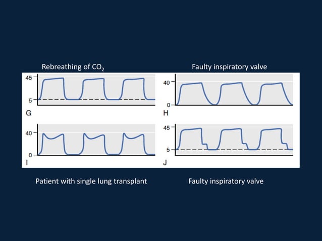 End tidal co2 and transcutaneous monitoring | PPTX | Lung and ...