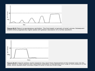 End tidal co2 and transcutaneous monitoring | PPTX