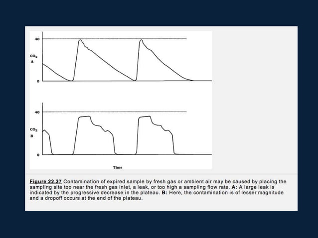 End tidal co2 and transcutaneous monitoring | PPTX | Lung and ...