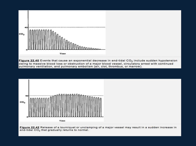 End tidal co2 and transcutaneous monitoring | PPTX | Lung and ...