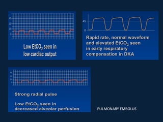 End tidal co2 and transcutaneous monitoring | PPTX