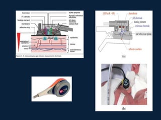 End tidal co2 and transcutaneous monitoring | PPTX