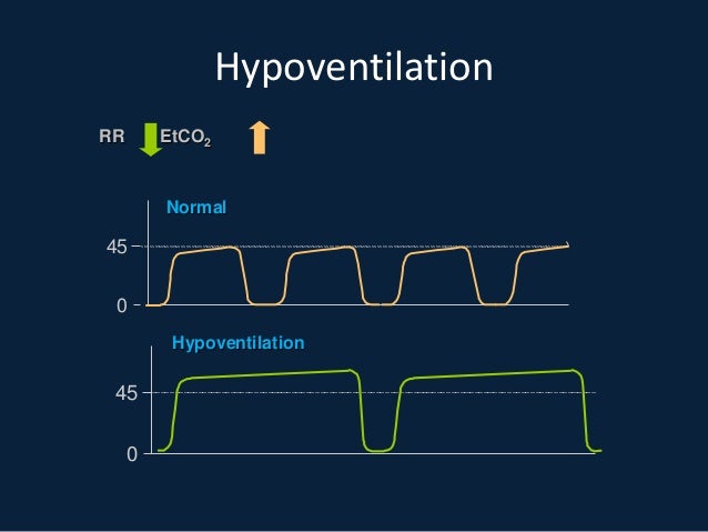 End tidal co2 and transcutaneous monitoring