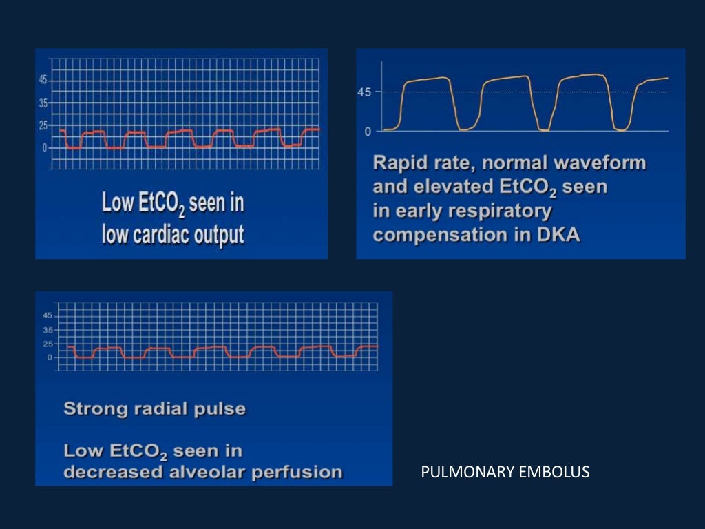 End tidal co2 and transcutaneous monitoring