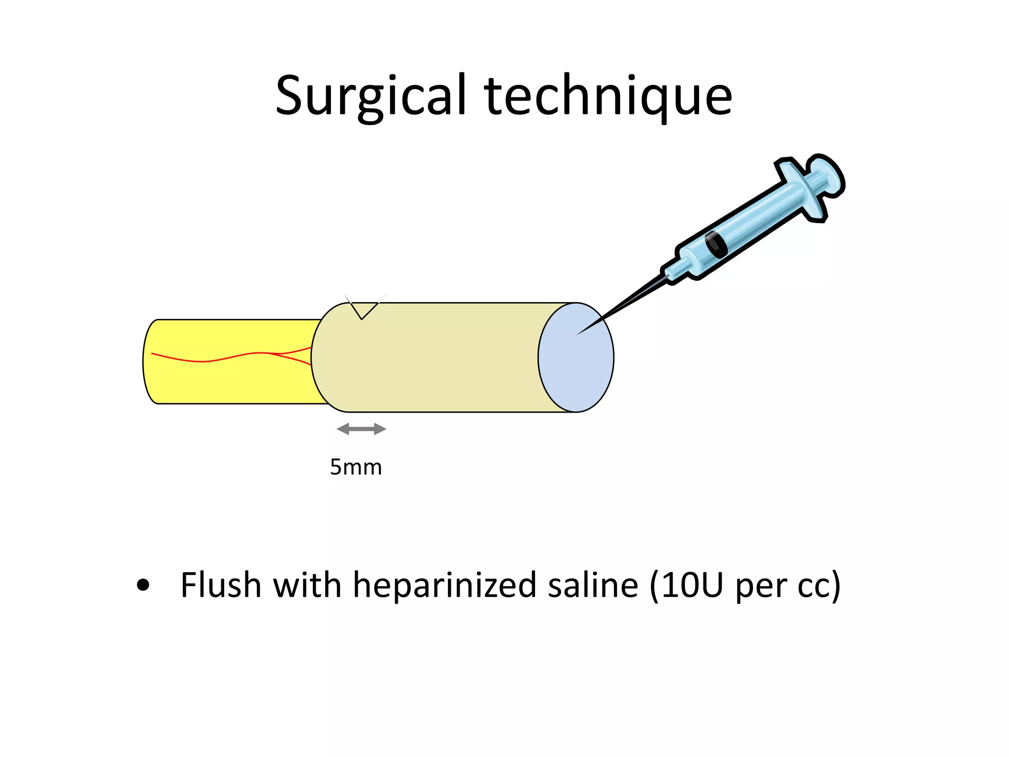 End to side nerve anastomosis & nerve conduits surgical technique attikon 2013 | PPTX