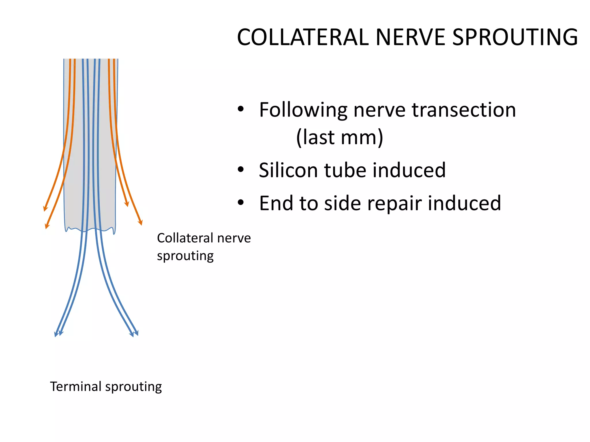 End to side nerve anastomosis & nerve conduits surgical technique ...